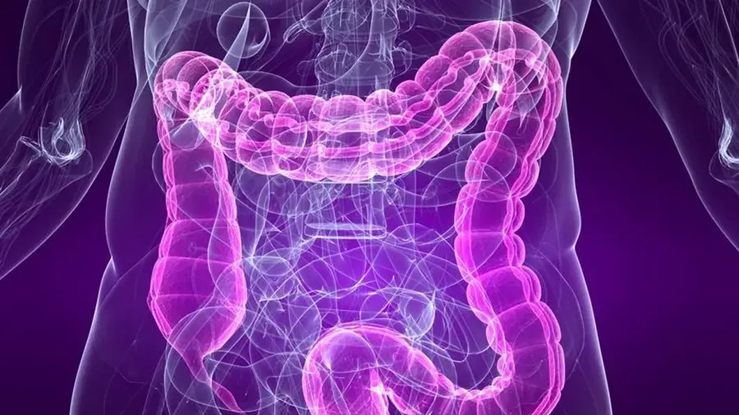 Care este schema de tratament pentru colon iritabil