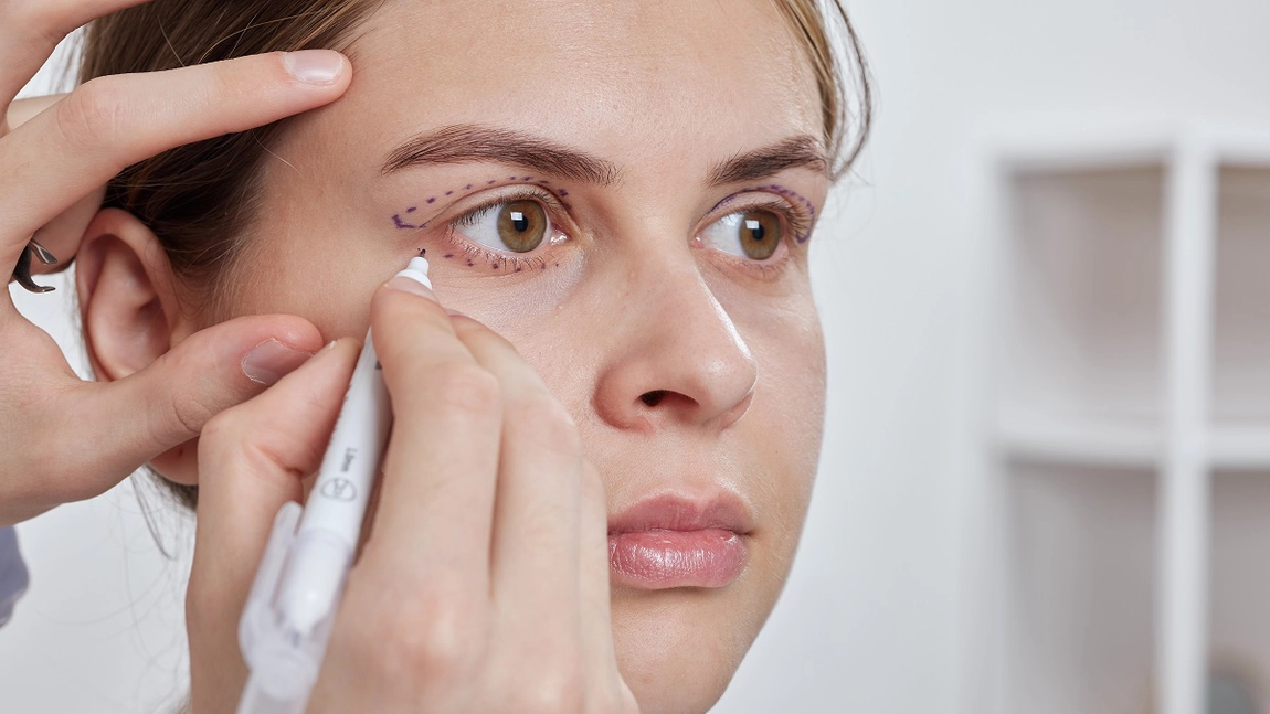 Cum să scapi de pungile de sub ochi: totul despre blefaroplastia ...