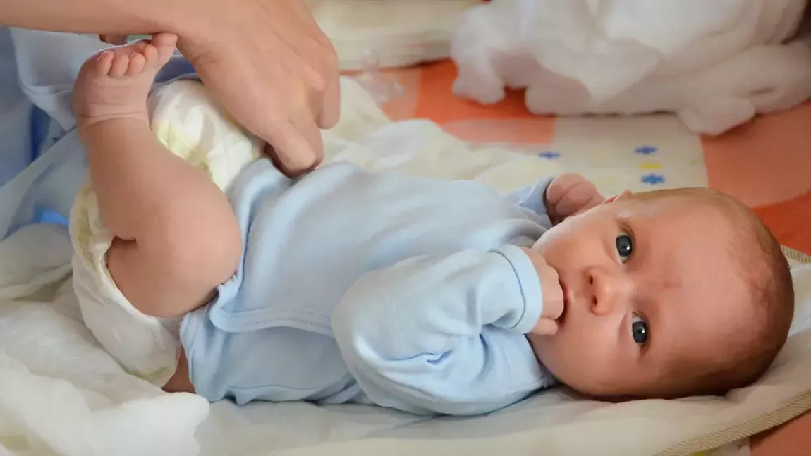 Fimoza la bebeluși. Când aceasta devine o problemă serioasă de sănătate?