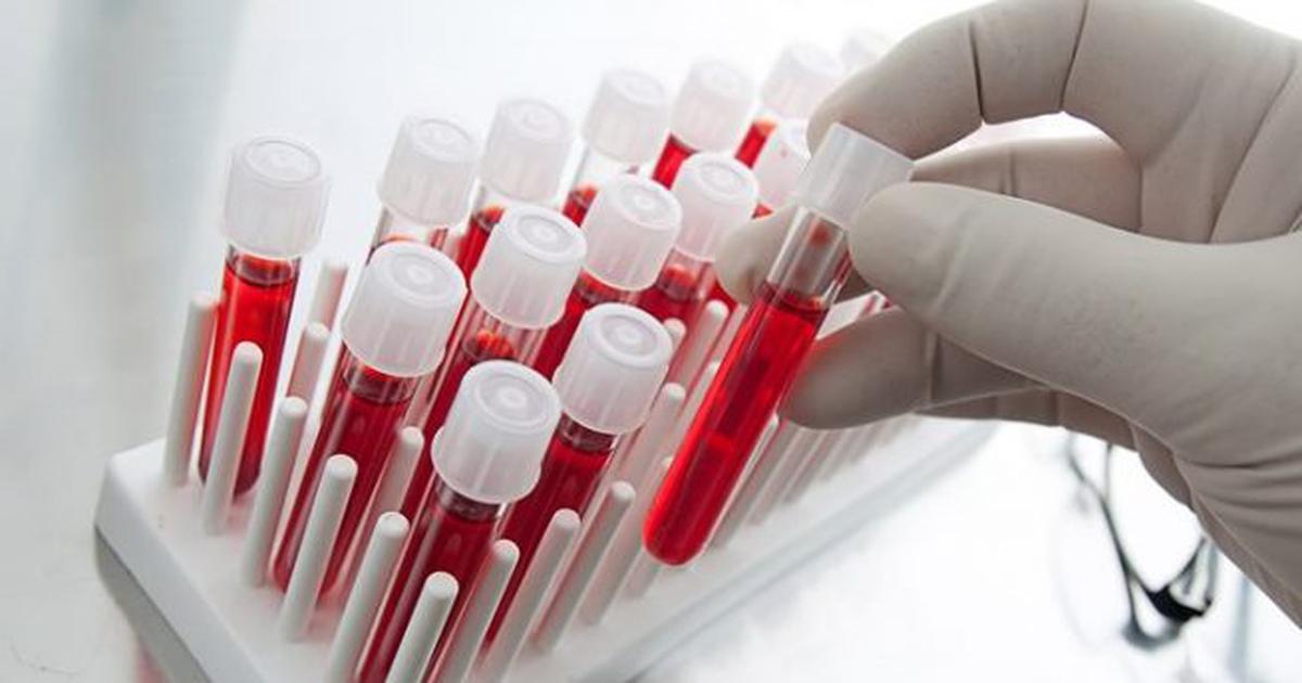 VTM ce înseamnă: Ce boli se ascund în spatele unor valori mai mici sau ...