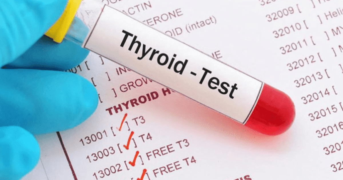 Tabel valori TSH. Care sunt indicii normali și când trebuie să te ...