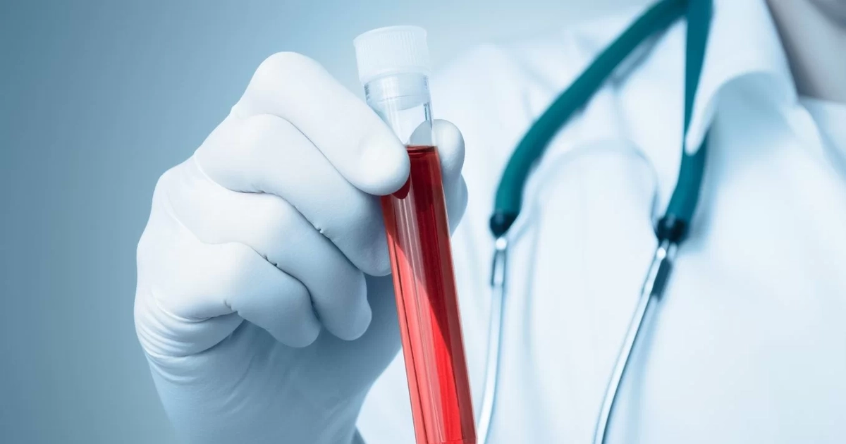 Tratament pentru feritina crescută. Cât de importantă este regimul ...