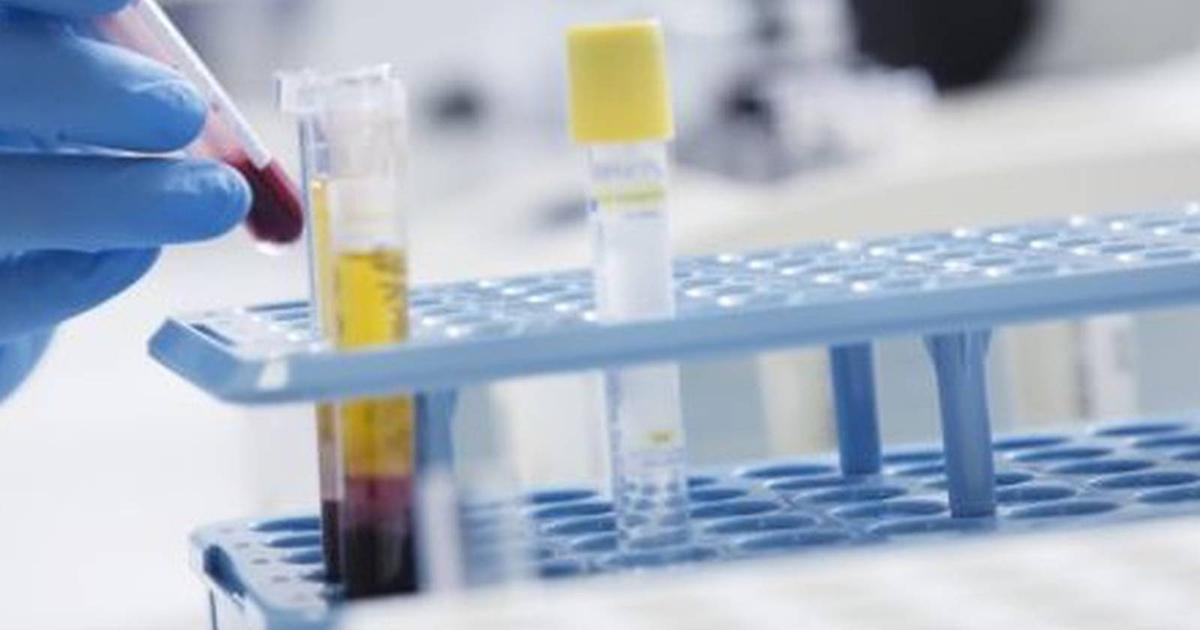 Tratament pentru trombocite mărite. Pastile prescrise de specialiști în ...