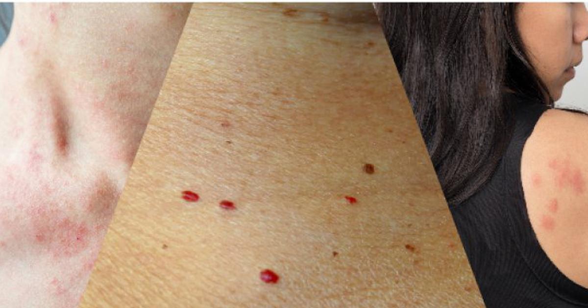 Ai pete pe piele? Iată imaginile care te vor determina să apelezi la un ...