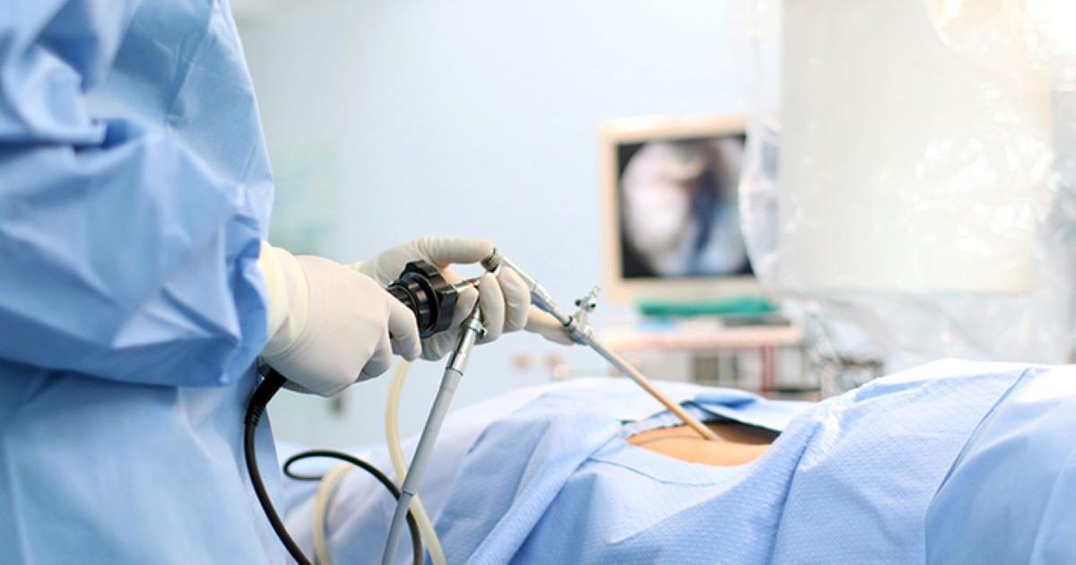 Cât durează o operație de chist ovarian? Ce trebuie să știi înainte de ...