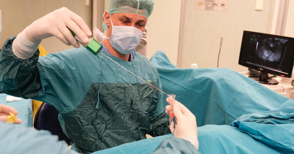 Biopsia de prostată - Ce este, când se recomandă și cum se desfășoară ...