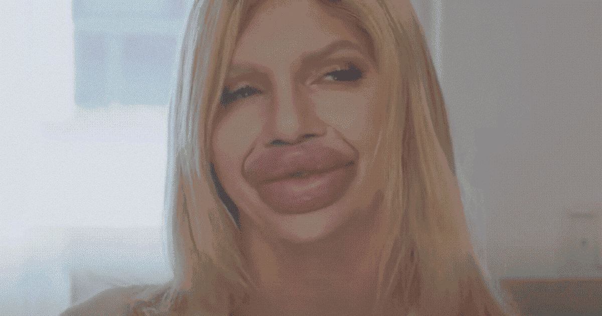 Vienna Wurstle are niște buze extrem de mari. Ceea ce a spus despre ele ...