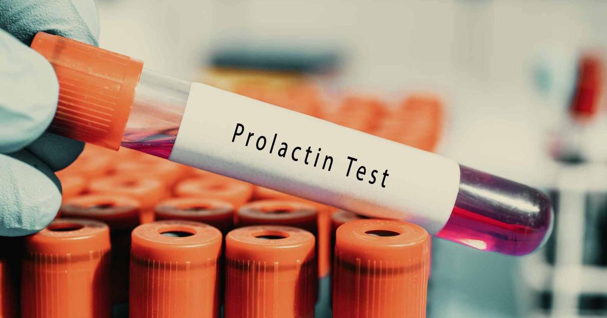 Prolactina crescută și tulburările pe care le poate genera! Iată ce ...