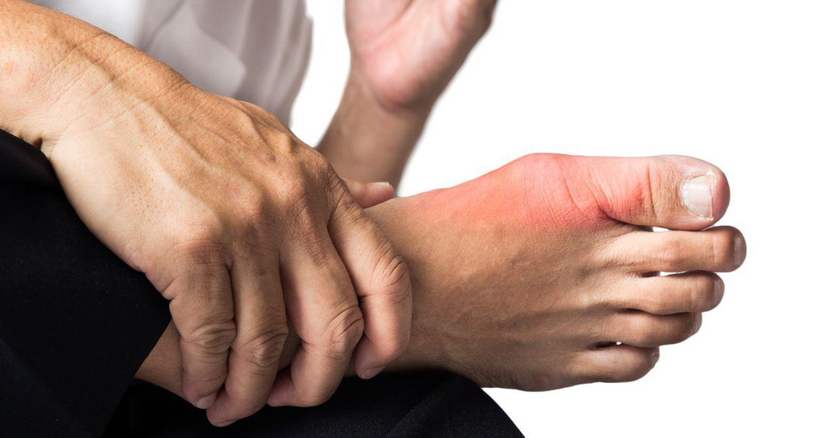 Imagini cu guta la picior. De unde provine disconfortul și factorii ...