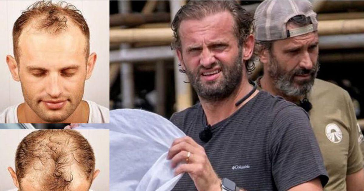 Sorin Brotnei suferă de o boală secretă! S-a dat de gol la Asia Express