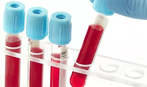 Volum mediu trombocitar crescut. Ce funcții se perturbă în organism din ...