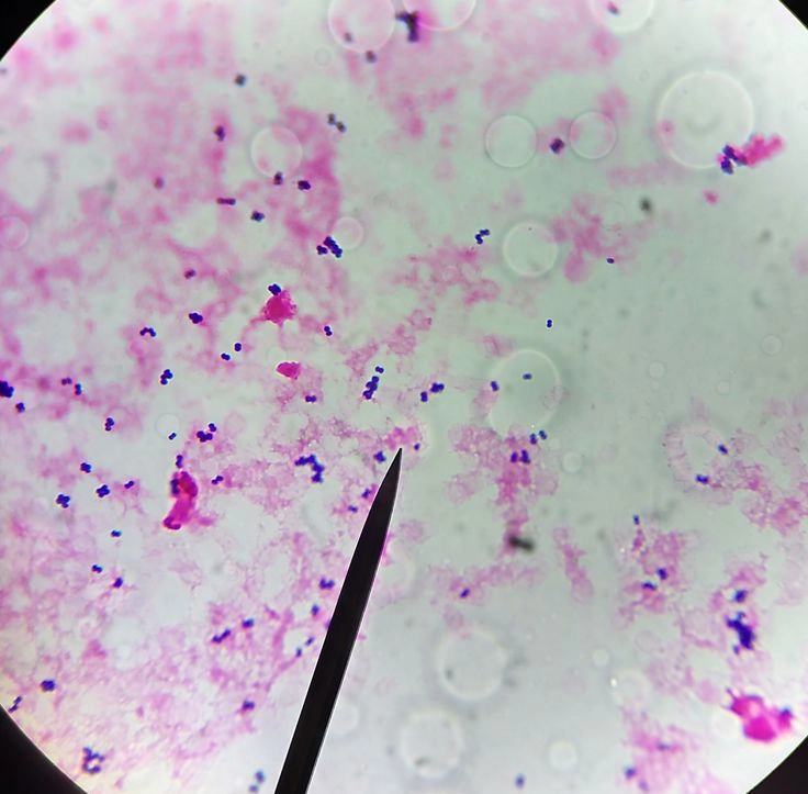 Cocobacili. Cum tratezi și eviți boala