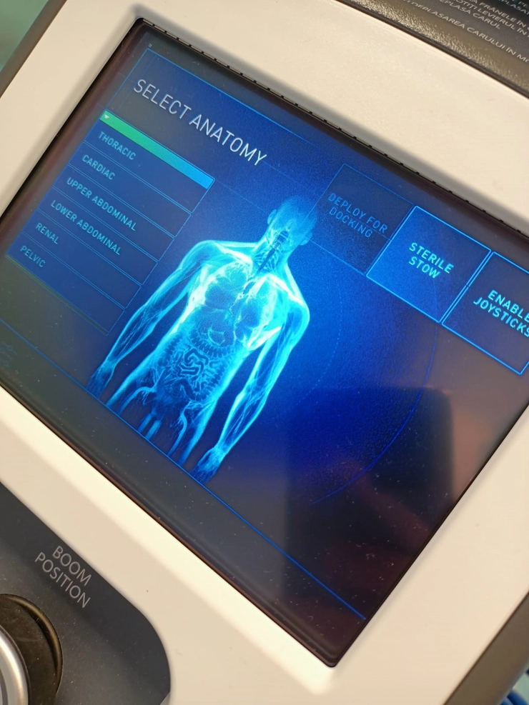 Chirurgia viitorului, la IRO Iași! Au fost realizate primele 50